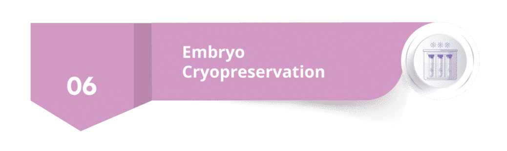 In-Vitro Fertilization (IVF) - Institute of Life