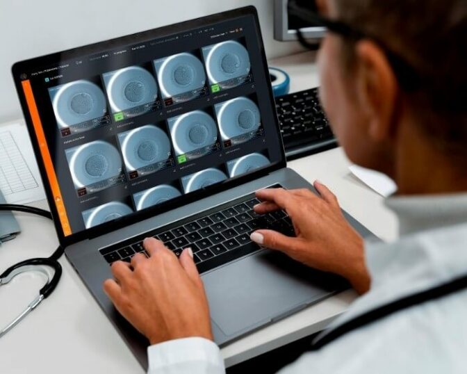 Information form for the use of the CHLOE OQ assessment tool ...